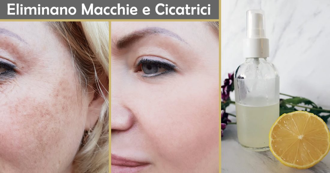 I 6 migliori oli per il viso per rimuovere le macchie della pelle e ...